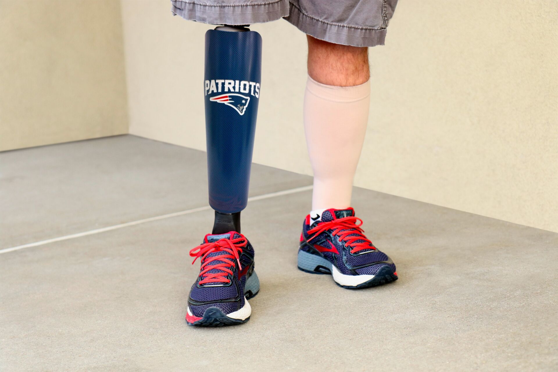 Photos - A Step Ahead Prosthetics